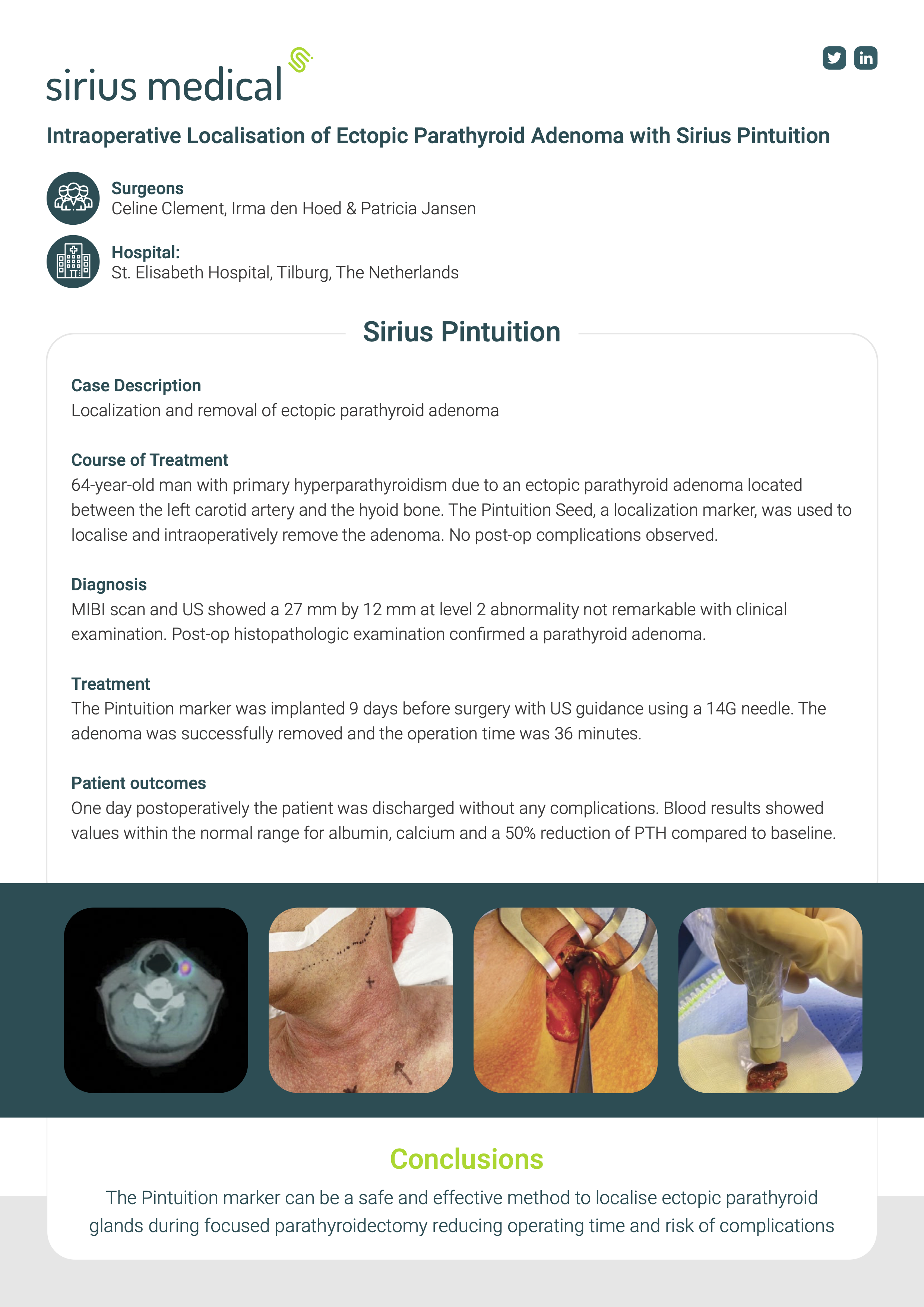 Intraoperative Localisation of Ectopic Parathyroid Adenoma with Sirius ...